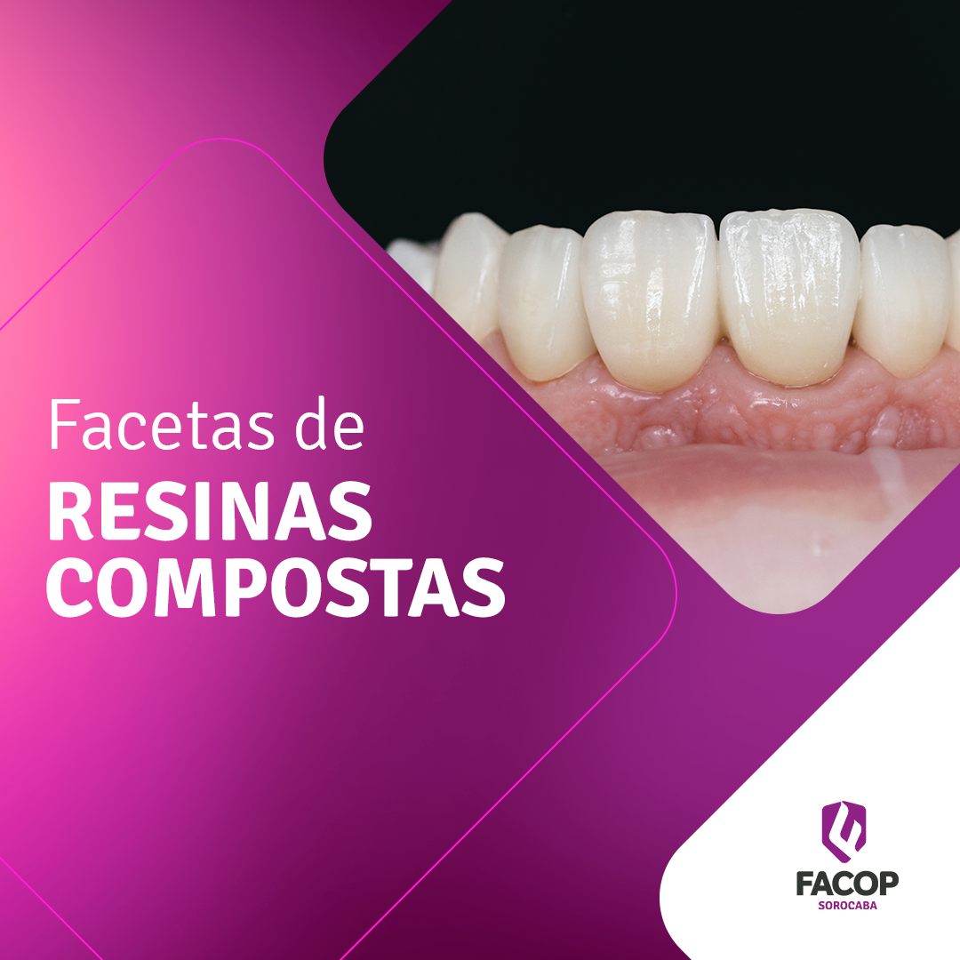 FACOP Sorocaba